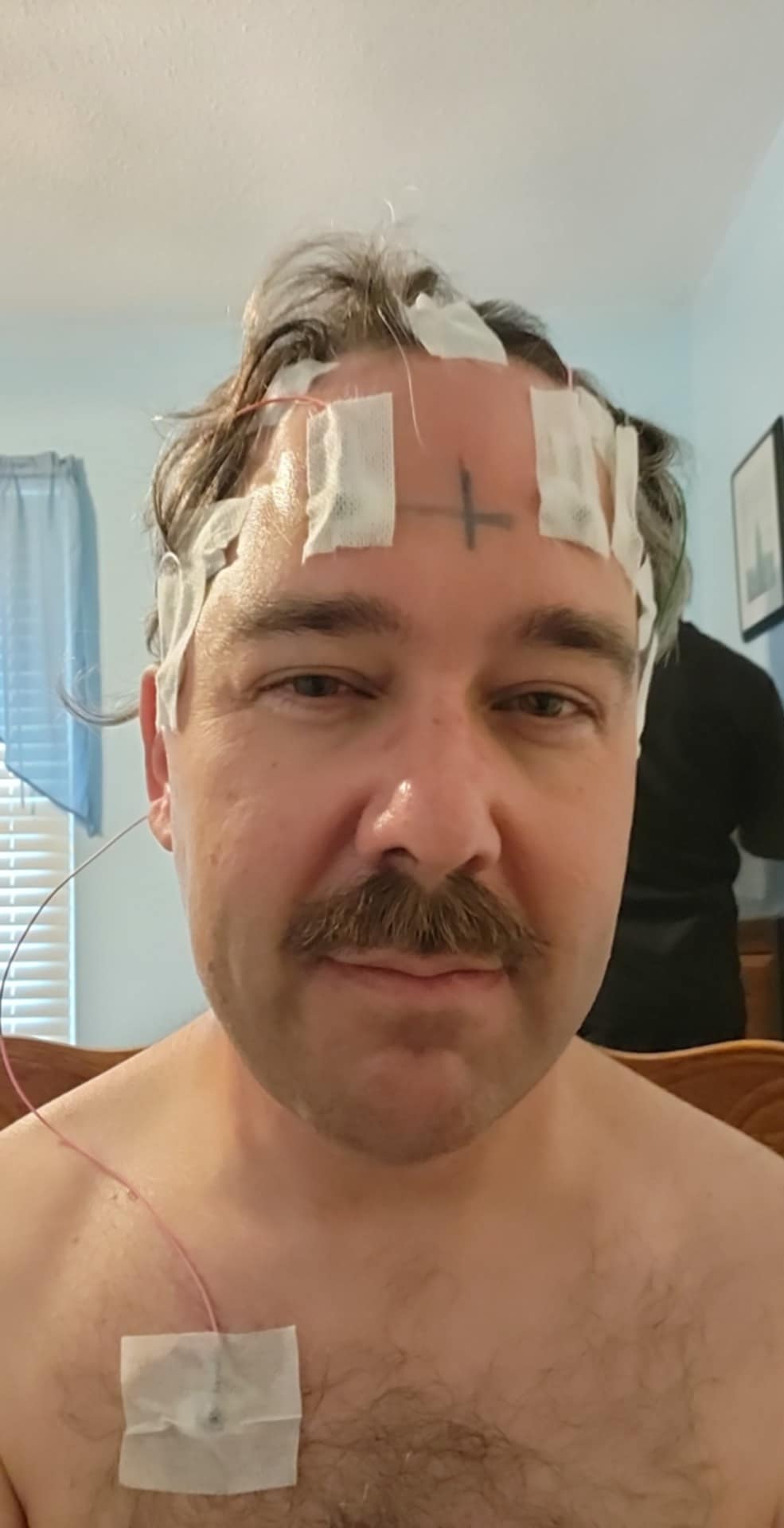 An EEG… at home. – The Catalpa Chronicles